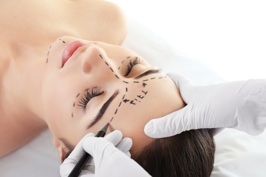 Polydioxanone threads lift for eye bags - Parkland Natural Health