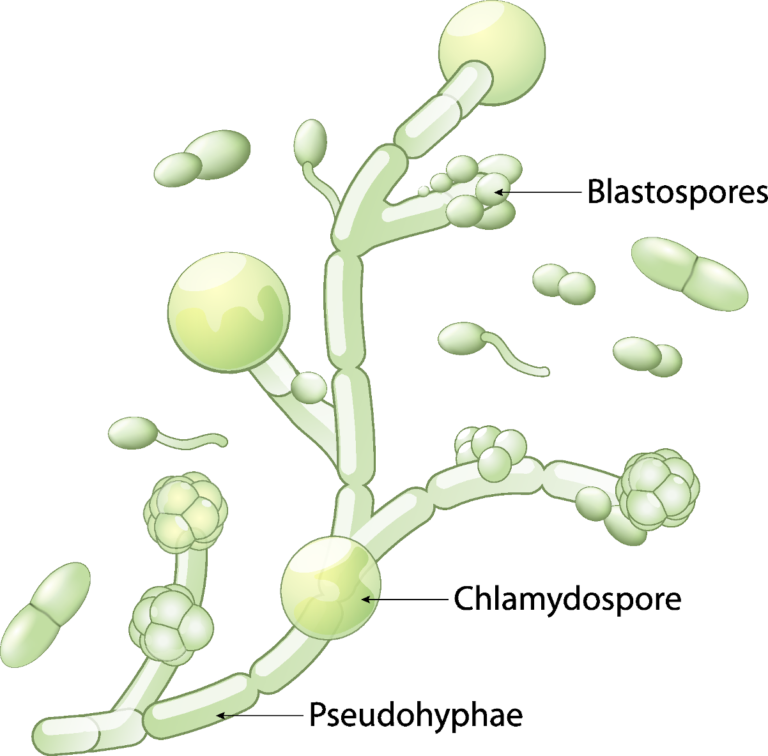 Understanding Candida Yeast Infections: Causes and Symptoms - Parkland ...
