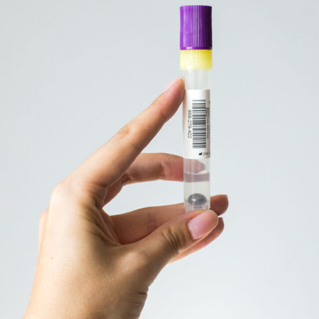 Order Microbiome test to see how gut bacteria impact health 🧑🏻‍⚕️