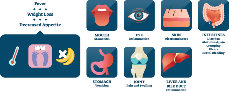 Crohn's Disease: What You Need To Know - Parkland Natural Health in London